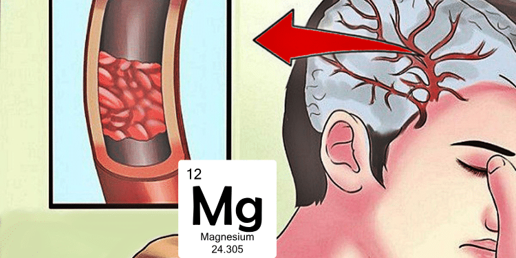 13 Warning Signs That You Immediately Need Magnesium and How to Get It