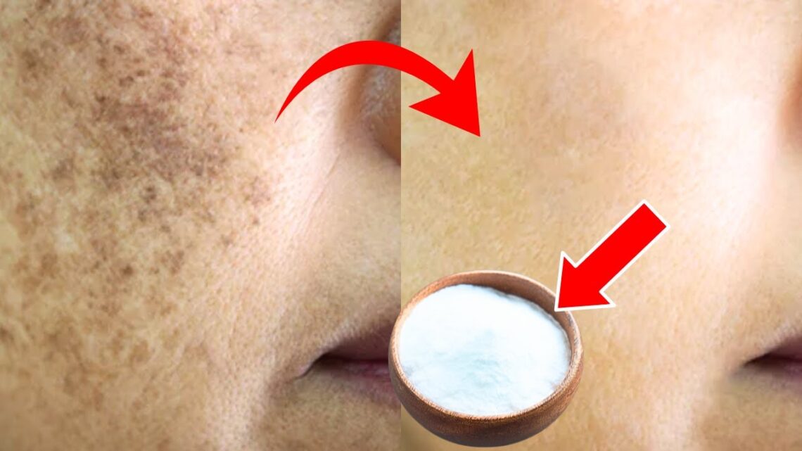How I ERASED My Age Spots with a CHEAP Kitchen Ingredient