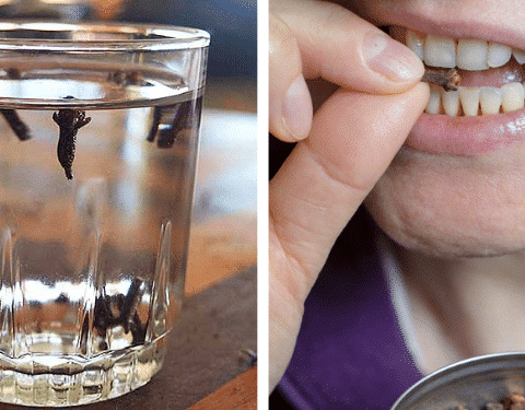 How to Make Clove Oil at Home and Why It Belongs in Every First Aid Kit