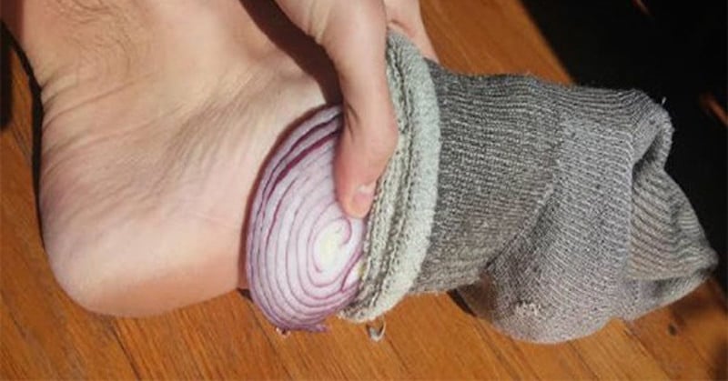 Put an Onion in Your Sock Before Bed, Wake Up to This!
