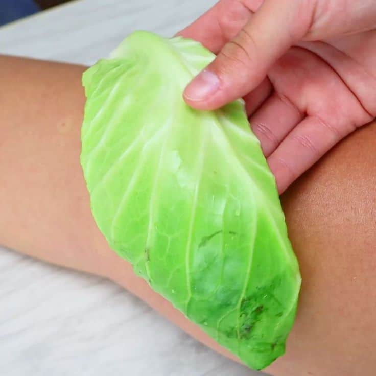 How to Apply Raw Cabbage Leaves for the Relief of Joint Pain