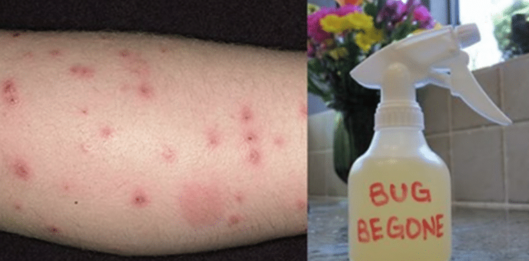 How to Make Homemade, Non-Toxic Mosquito Repellent That Works!