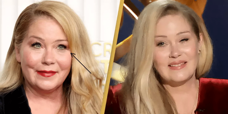 Christina Applegate Reveals 5 Unusual Symptoms She Overlooked Before Her MS Diagnosis – Here's ...